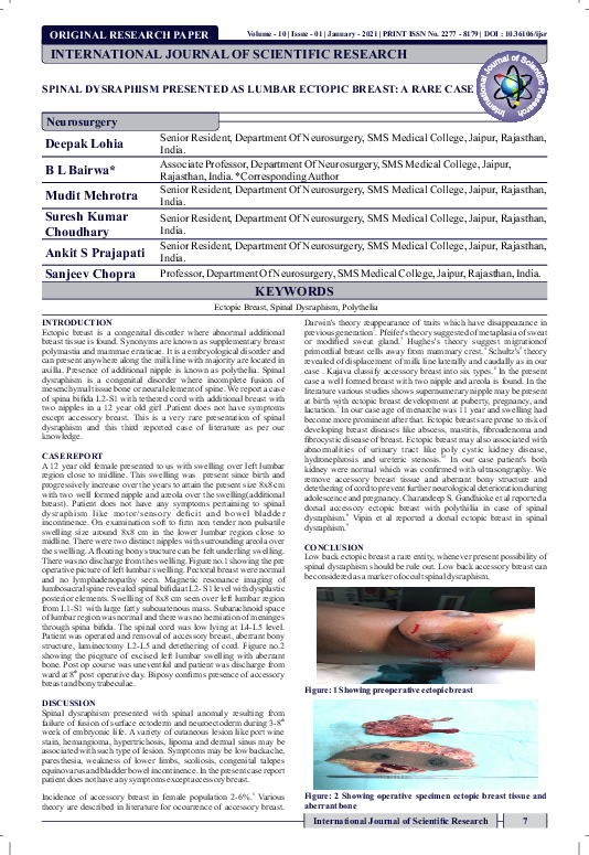 (PDF) Spinal dysraphism case report
