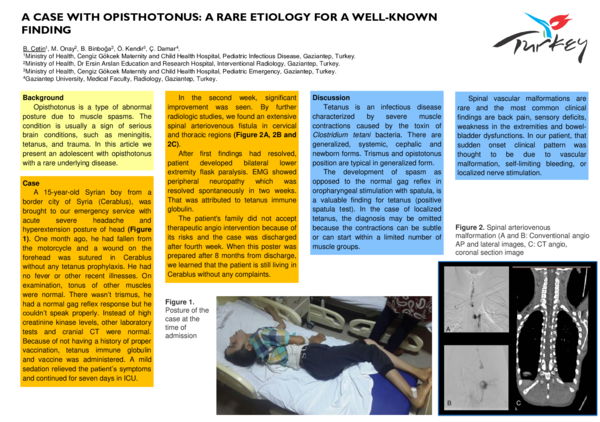 (PDF) A Case with Opisthotonus: A Rare Etiology for a Well-Known Finding