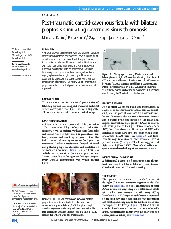(PDF) Post-traumatic carotid-cavernous fistula with bilateral proptosis ...