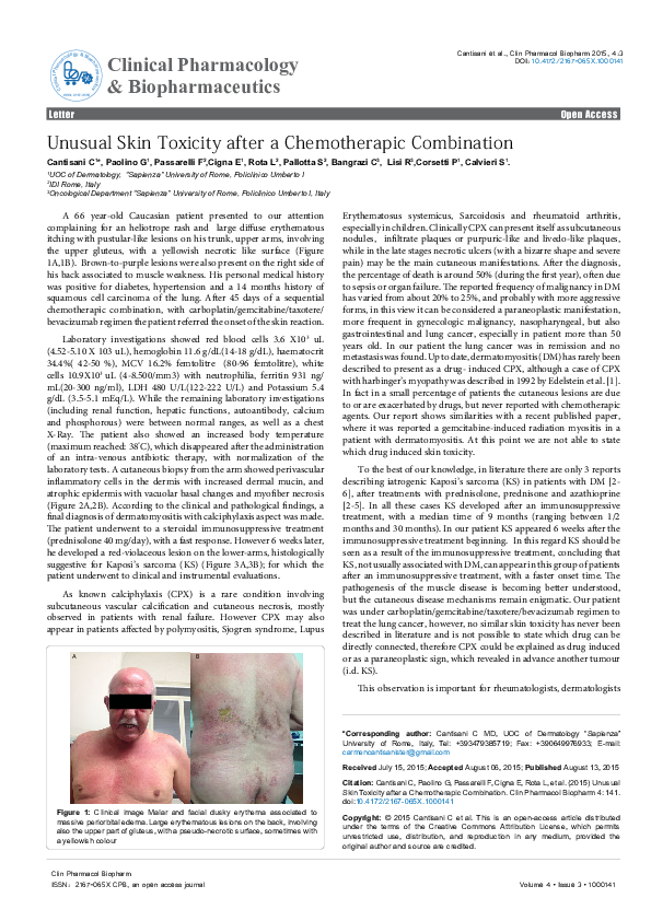 (PDF) Unusual Skin Toxicity after a Chemotherapic Combination