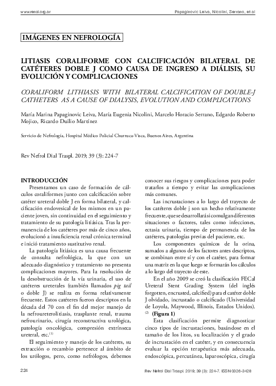 (PDF) Coraliform litiasis with bilateral calcification of double-J ...