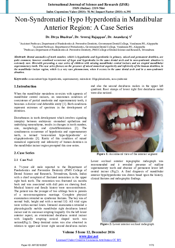 (PDF) Hypo-Hyperdontia Case Series in Mandibular Anterior