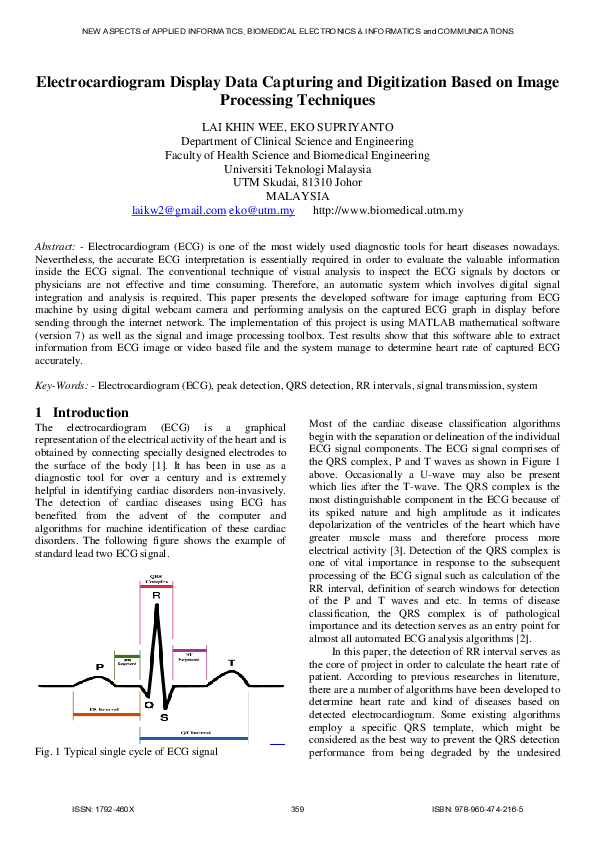 Pdf Electrocardiogram Display Data Capturing And Digitization Based