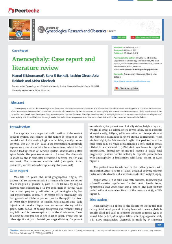 (PDF) Anencephaly: Case report and literature review