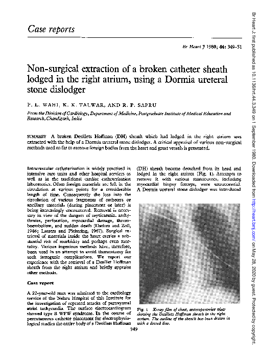 (PDF) Non-surgical Removal of Catheter Sheath in Heart
