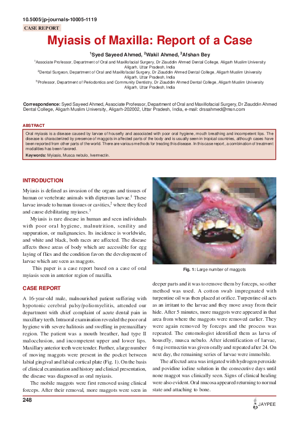(PDF) Myiasis of Maxilla: Report of a Case