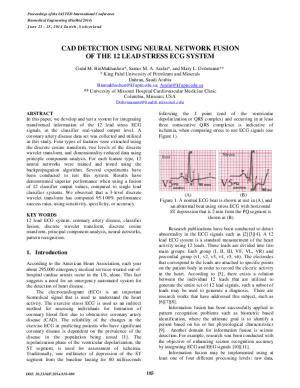 (PDF) CAD Detection using Neural Network Fusion of the 12 Lead Stress ECG System