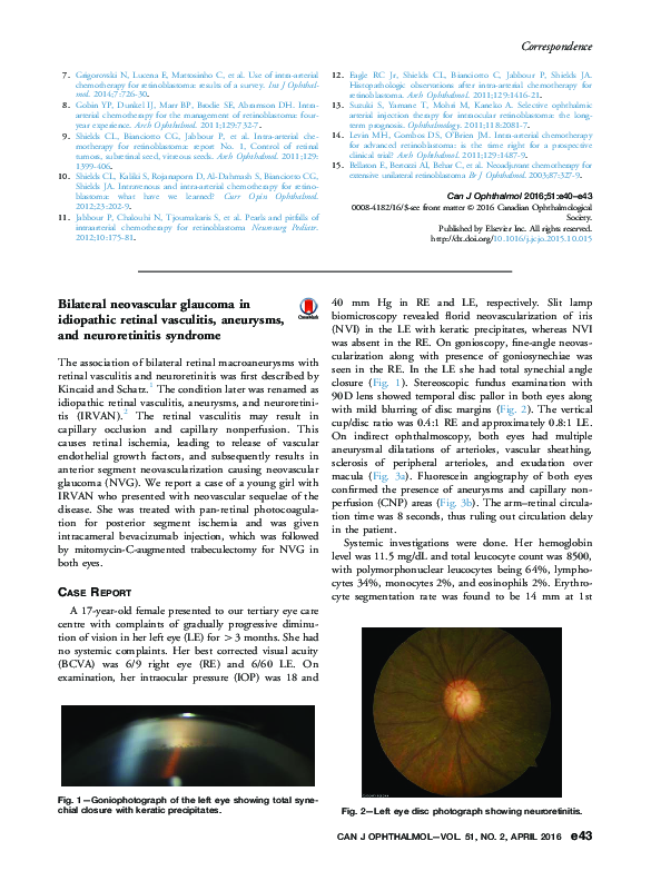 (PDF) Bilateral neovascular glaucoma in idiopathic retinal vasculitis ...
