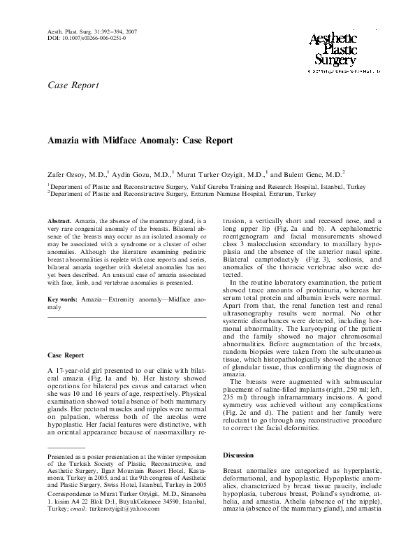 (PDF) Amazia with Midface Anomaly: Case Report