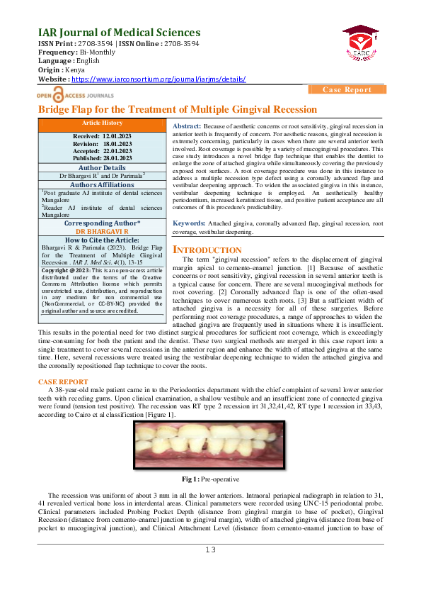 (PDF) Bridge Flap for the Treatment of Multiple Gingival Recession