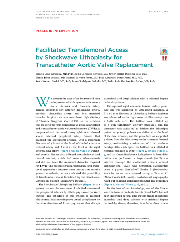 (PDF) Facilitated Transfemoral Access by Shockwave Lithoplasty for ...