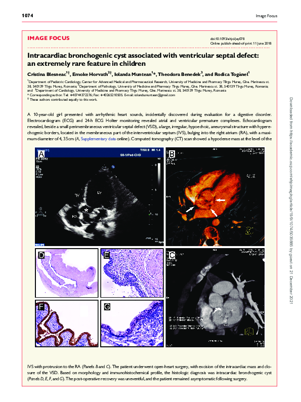 (PDF) Intracardiac bronchogenic cyst associated with ventricular septal ...
