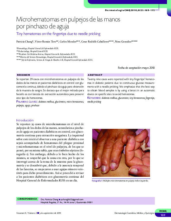 (PDF) Microhematomas en pulpejos de las manos por pinchazo de aguja ...