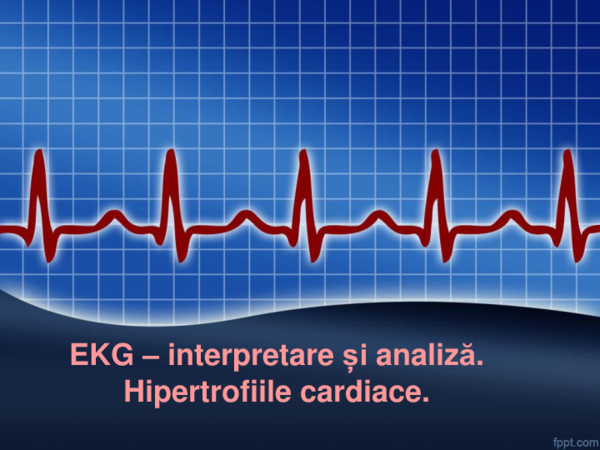 (PDF) EKG-Interpretare. Hipertofia