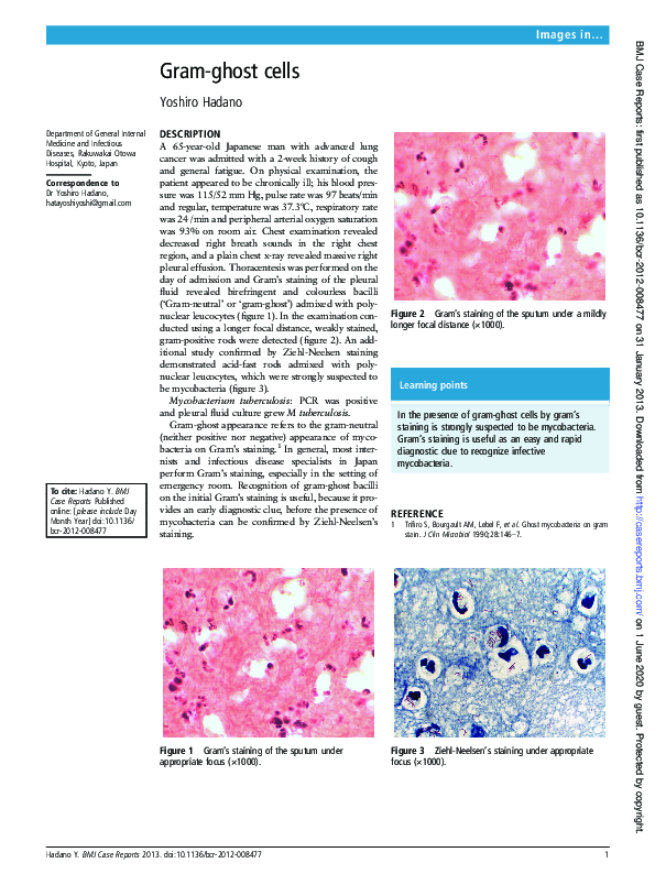 (PDF) Gram-ghost cells