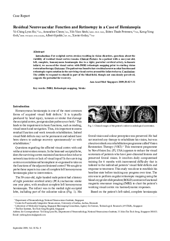 (PDF) Residual neurovascular function and retinotopy in a case of ...
