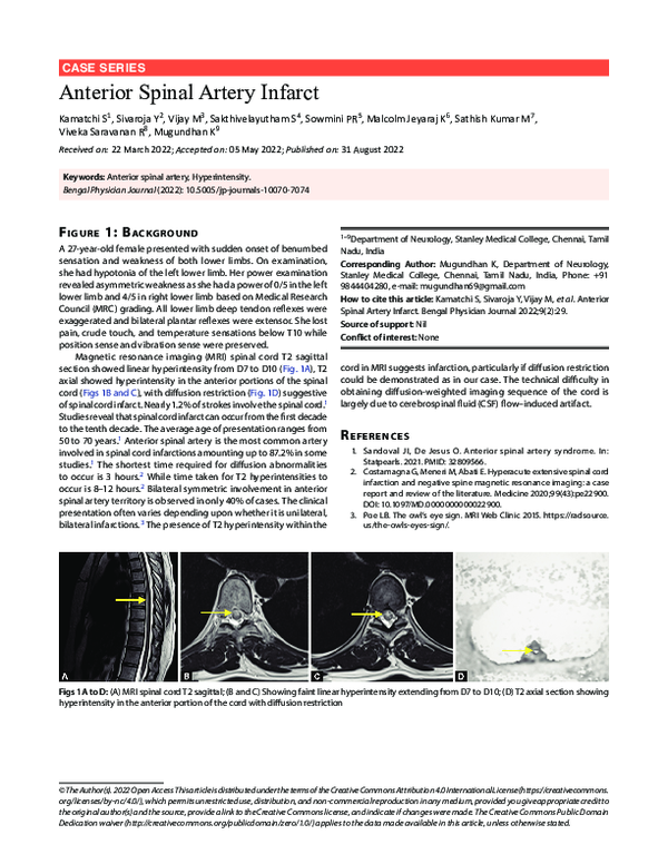 (PDF) Anterior Spinal Artery Infarct