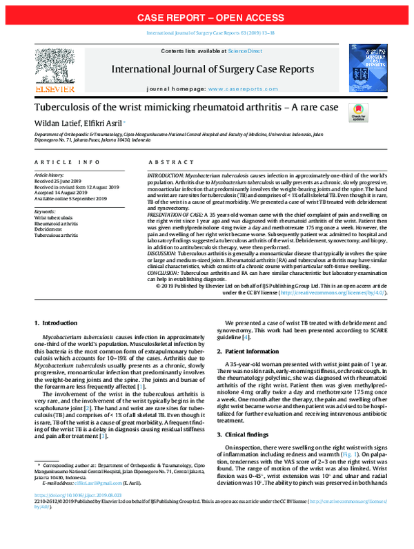 Tuberculosis of the wrist mimicking rheumatoid arthritis – A rare case