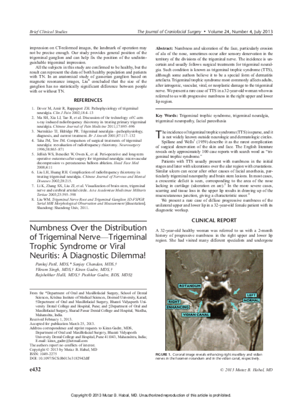 Pdf Numbness Over The Distribution Of Trigeminal Nerve—trigeminal Trophic Syndrome Or Viral