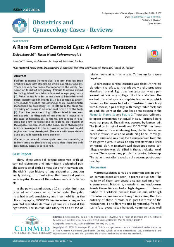 (PDF) A Rare Form of Dermoid Cyst: A Fetiform Teratoma