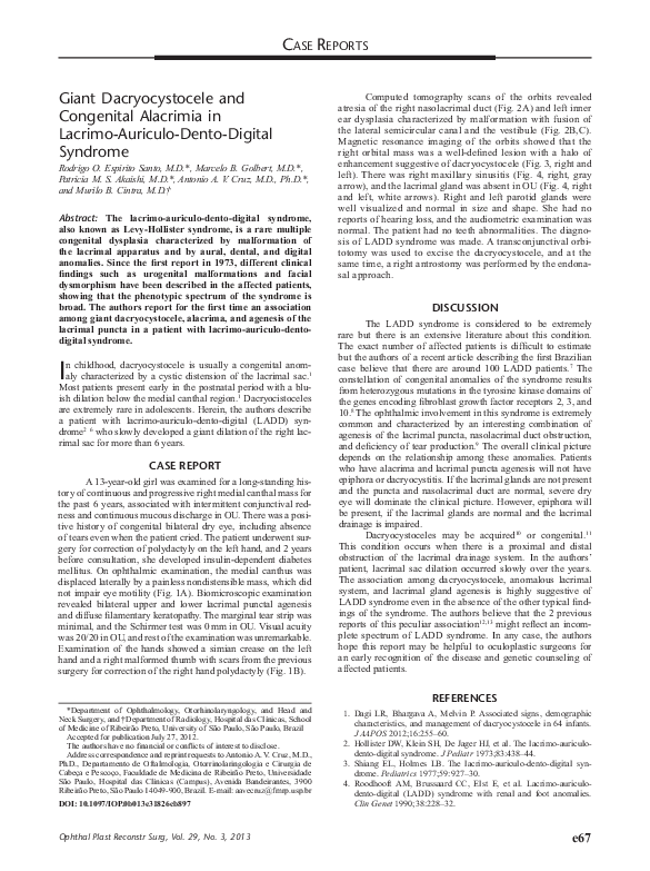 (PDF) Giant Dacryocystocele and Congenital Alacrimia in Lacrimo ...