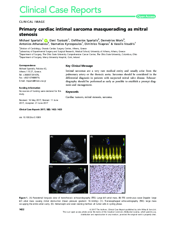 (PDF) Primary cardiac intimal sarcoma masquerading as mitral stenosis