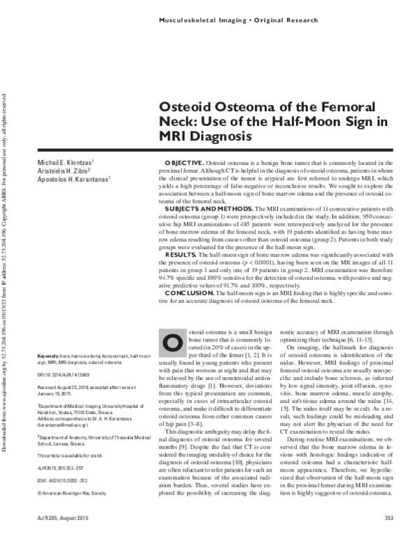 (PDF) Osteoid Osteoma of the Femoral Neck: Use of the Half-Moon Sign in ...