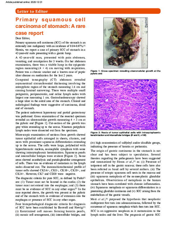 (PDF) Primary squamous cell carcinoma of stomach: A rare case report
