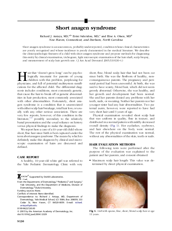 (PDF) Short anagen syndrome