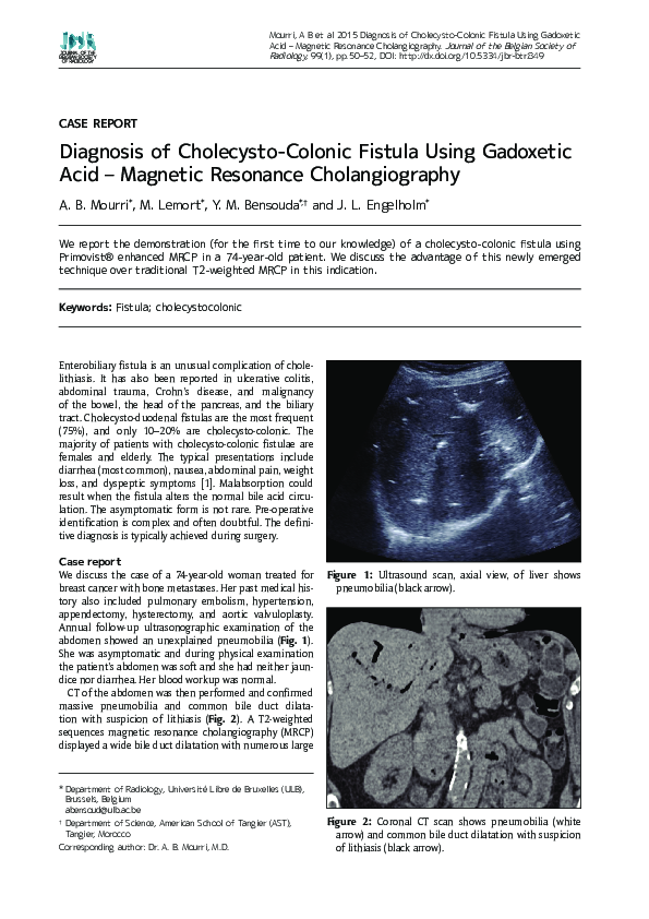 (PDF) Diagnosis of Cholecysto-Colonic Fistula Using Gadoxetic Acid ...