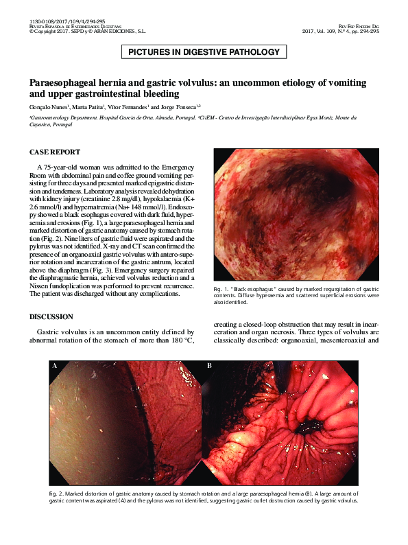 (PDF) Paraesophageal hernia and gastric volvulus: an uncommon etiology ...