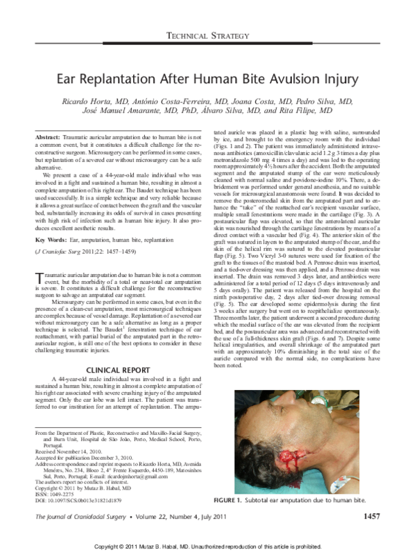 (PDF) Ear Replantation After Human Bite Avulsion Injury