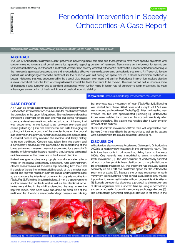 (PDF) Periodontal Intervention in Speedy Orthodontics-A Case Report