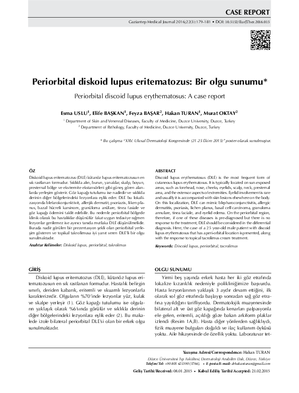 (PDF) Periorbital discoid lupus erythematosus: A case report