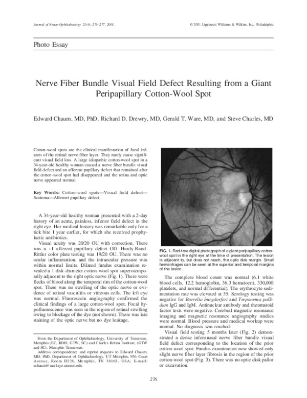 (PDF) Nerve Fiber Bundle Visual Field Defect Resulting from a Giant ...