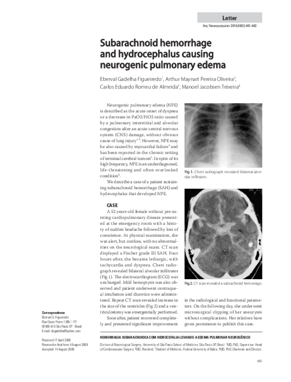 (PDF) Subarachnoid hemorrhage and hydrocephalus causing neurogenic pulmonary edema