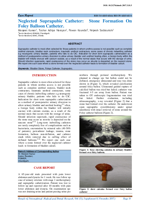 (PDF) Neglected Suprapubic Catheter: Stone Formation On Foley Balloon Catheter