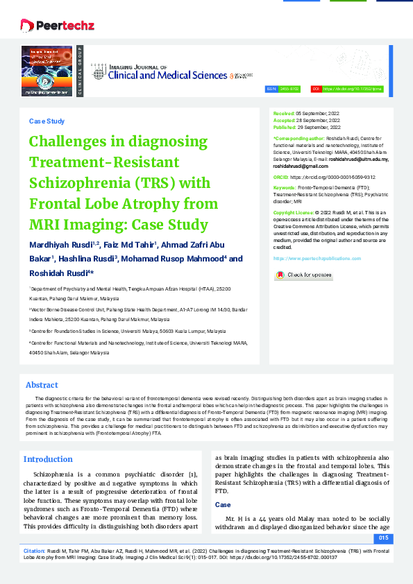 (PDF) Challenges in diagnosing Treatment-Resistant Schizophrenia (TRS ...