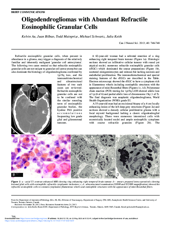 (PDF) Oligodendrogliomas with Abundant Refractile Eosinophilic Granular ...