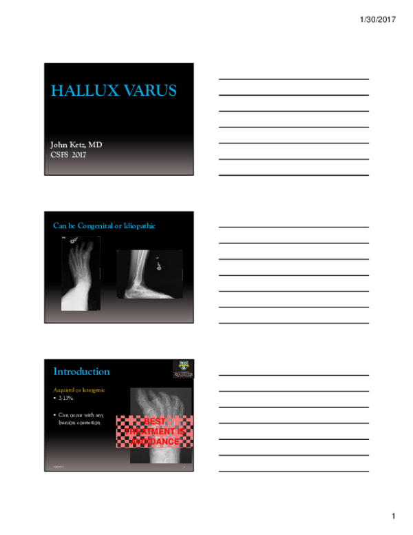(PDF) Hallux Varus | Tim kilmartin - Academia.edu