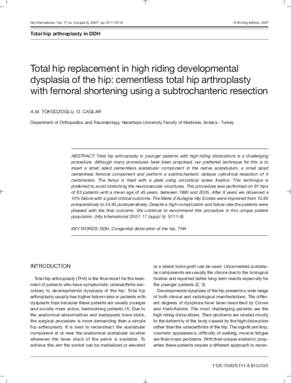 (PDF) Total hip replacement in high riding developmental dysplasia of ...