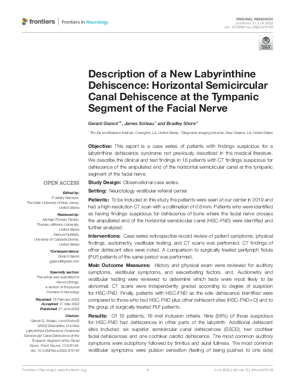 (PDF) Description of a New Labyrinthine Dehiscence: Horizontal ...