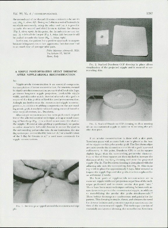 (PDF) A Simple Postoperative Stent Dressing After Nipple-Areola ...