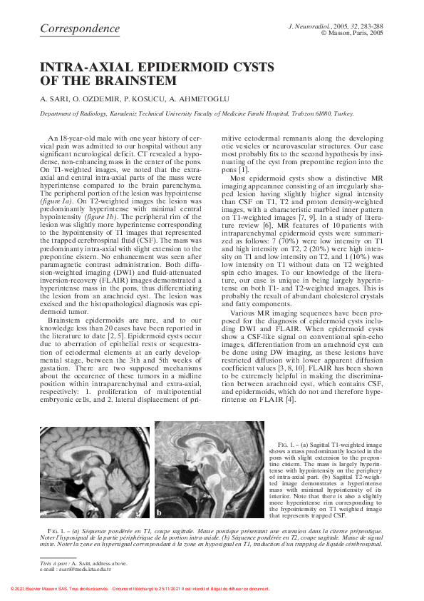 (PDF) Intra-axial epidermoid cysts of the brainstem