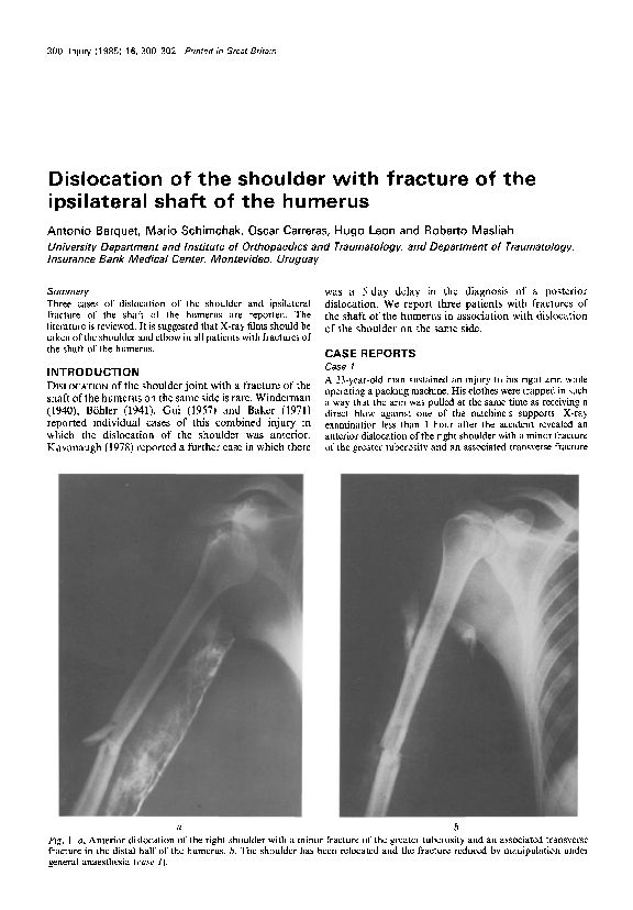(PDF) Shoulder Dislocation with Humeral Fracture