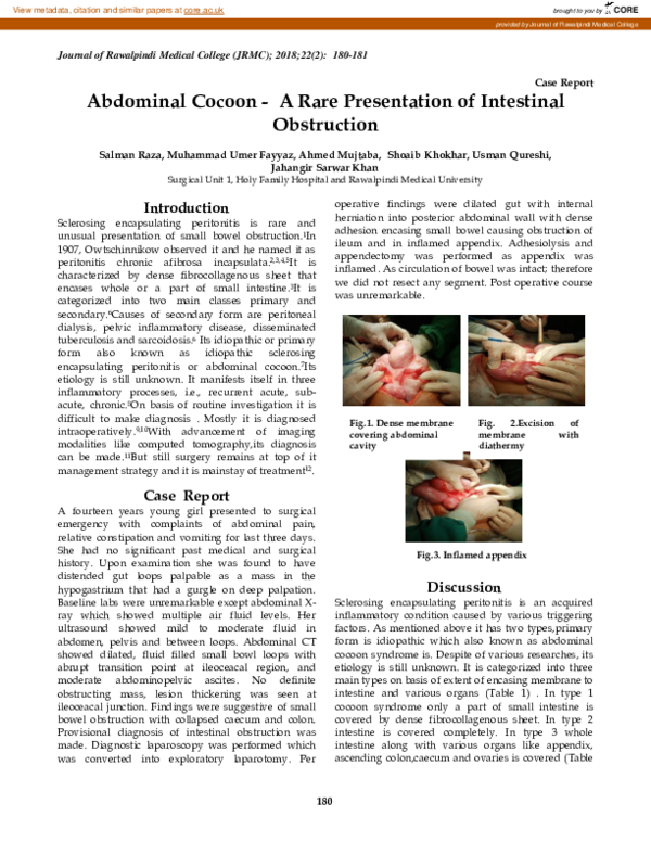 (PDF) Abdominal Cocoon - A Rare Presentation of Intestinal Obstruction