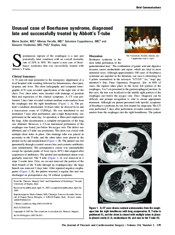 (PDF) Unusual case of Boerhaave syndrome, diagnosed late and ...