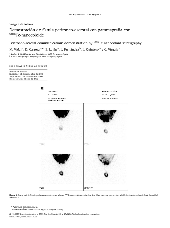 (PDF) Demostración de fístula peritoneo-escrotal con gammagrafía con ...