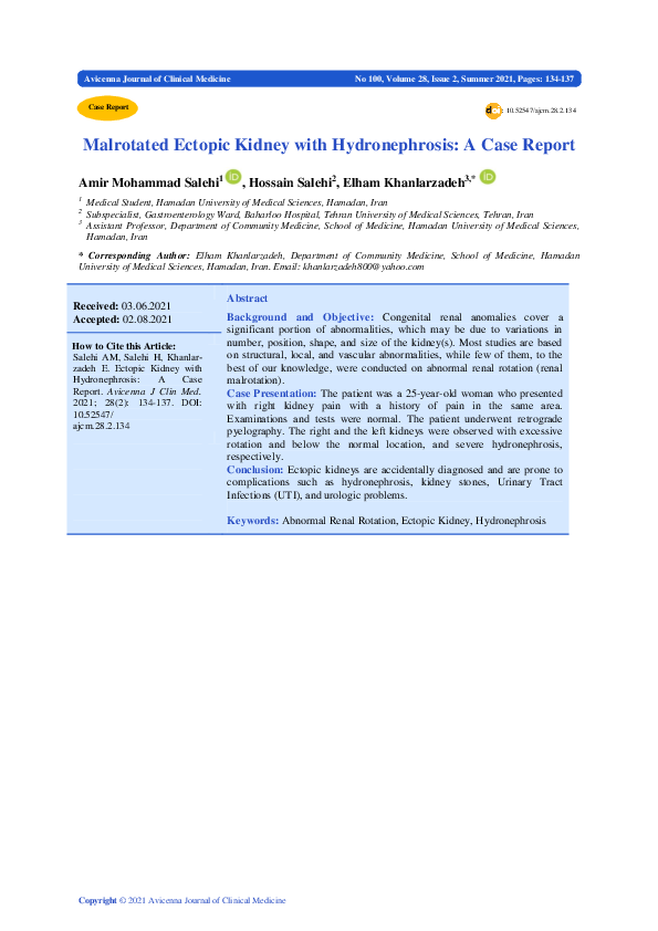 (PDF) Malrotated Ectopic Kidney with Hydronephrosis: A Case Report