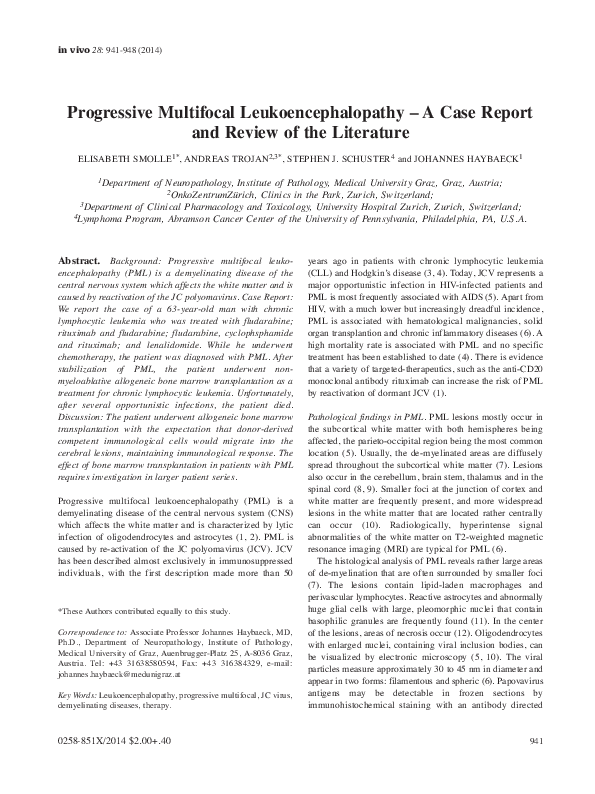 (PDF) Progressive Multifocal Leukoencephalopathy – A Case Report and ...